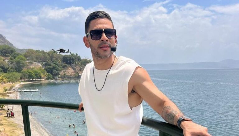 Así se vería Alex Carranza con un procedimiento estético